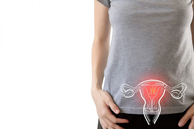 Miomas Uterinos. Diagnóstico e Avaliação.